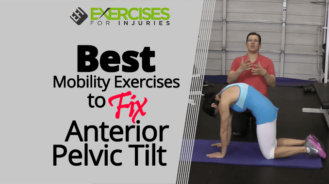How To Fix Anterior Pelvic Tilt With Stretches Exercises
